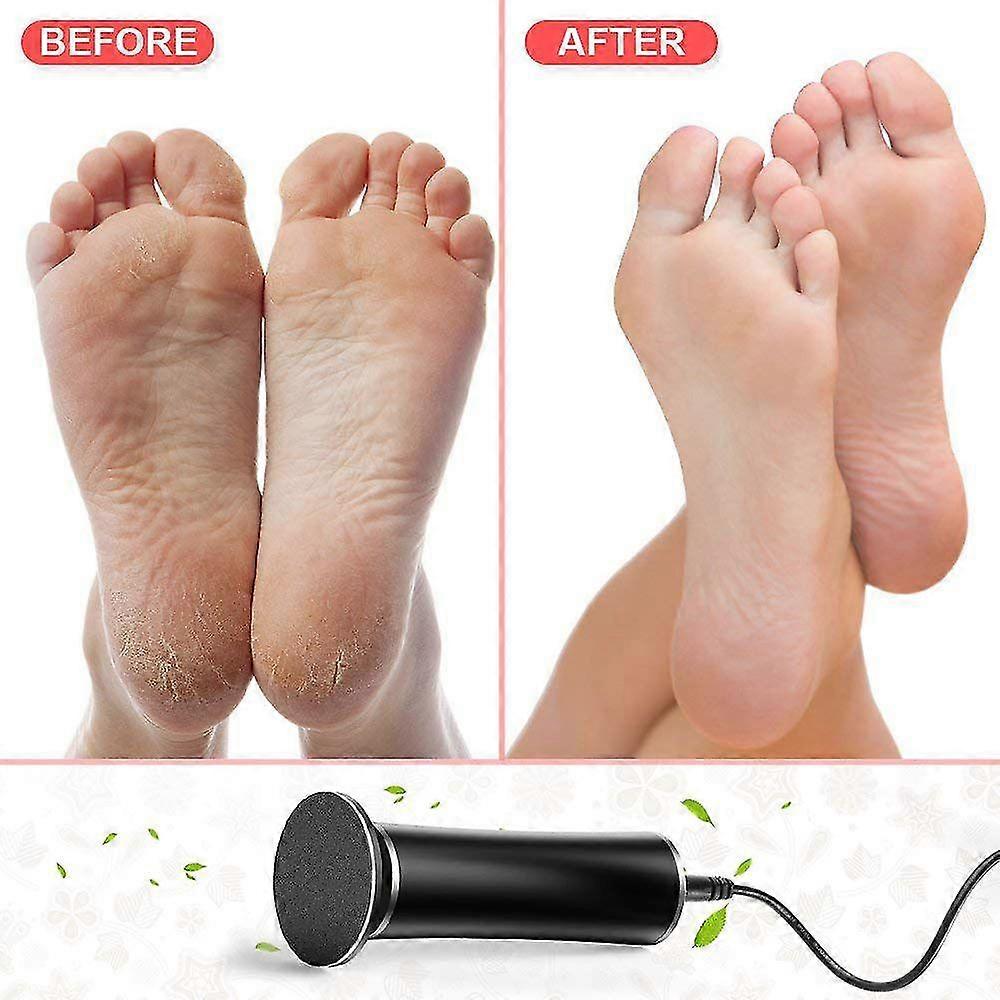 Electronic Foot File Callus Remover Tool Speed Adjustable Electric Foot ...