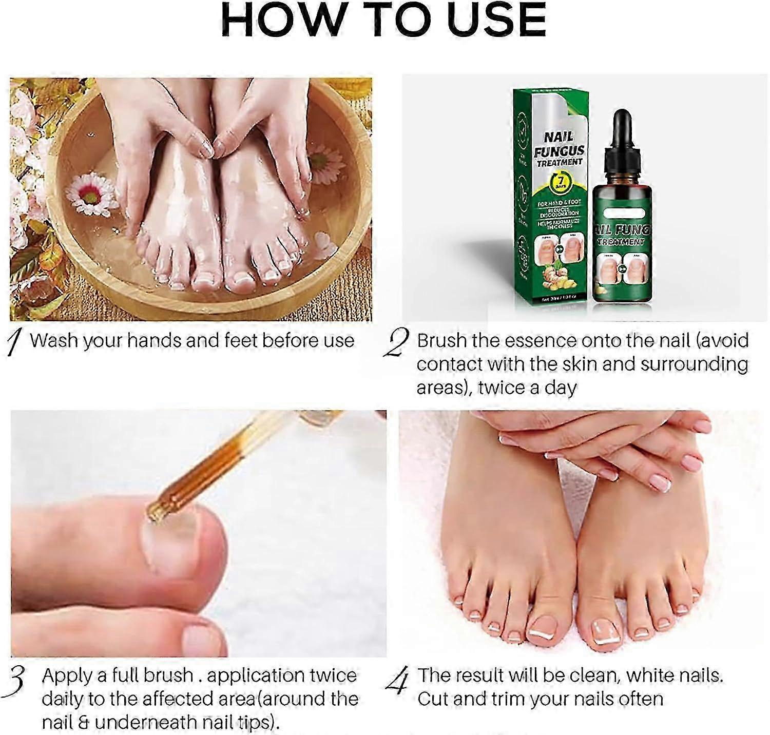 Ginger Nail Fungus Treatment Extra Strength, Anti Fungal Nail Treatment ...