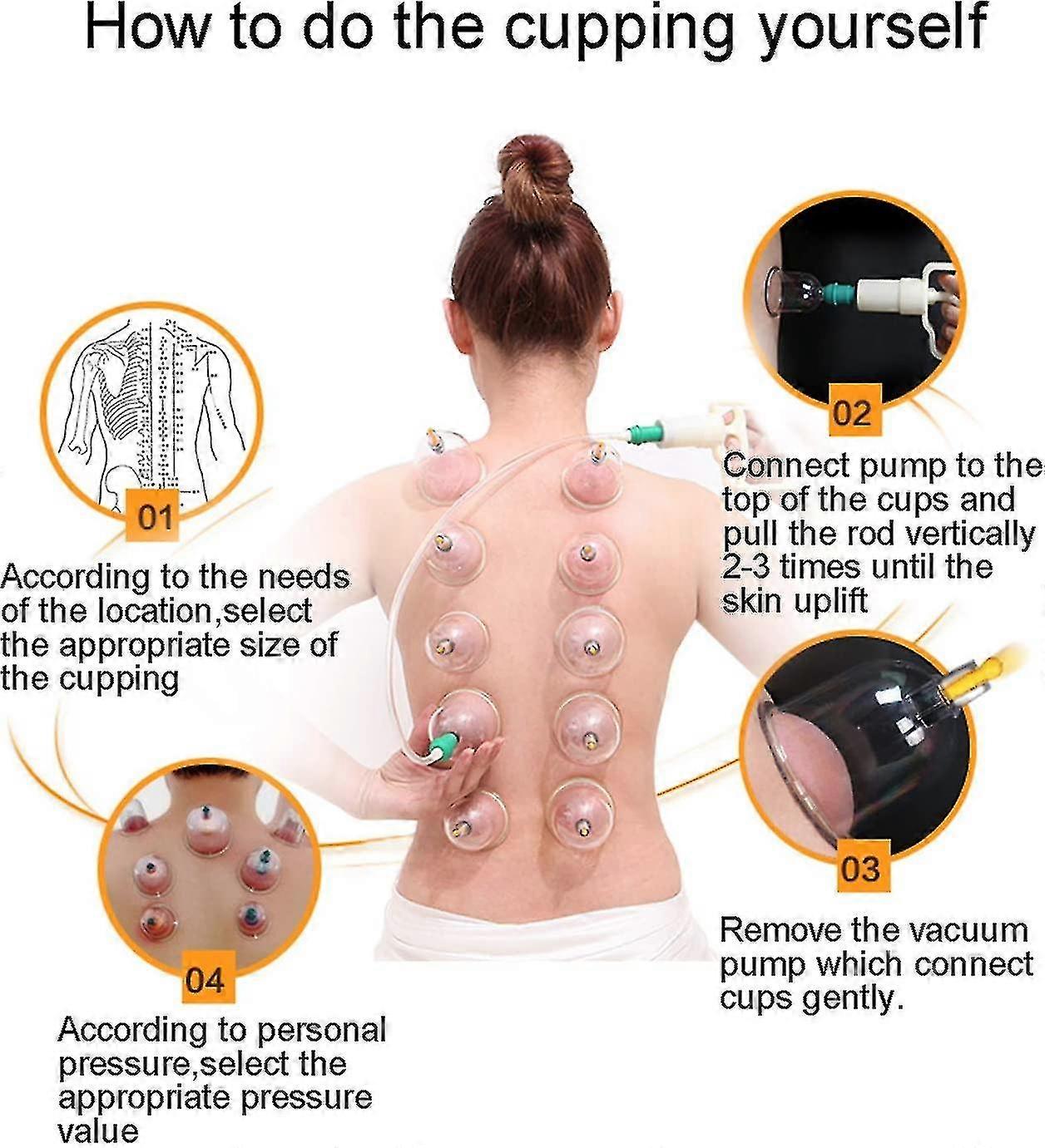 Cupping Therapy Sets,24 Cups Cupping Set With Pump Vacuum Suction Cups ...