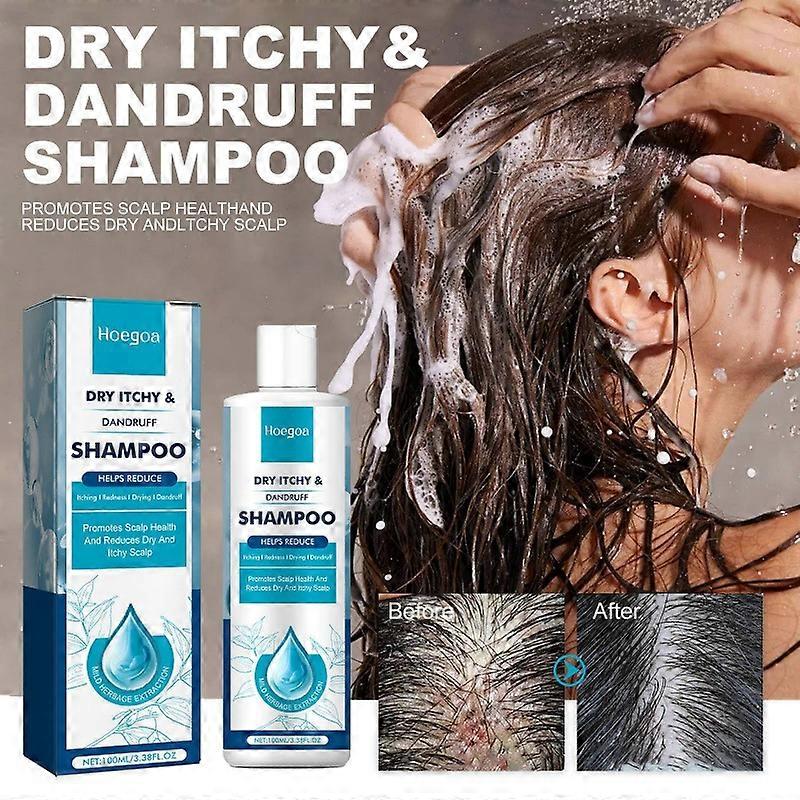 Anti-Dandruff Shampoo, Dandruff Shampoo for Dry Itchy Scalp, Scalp Care Therapy Shampoo Relief ...