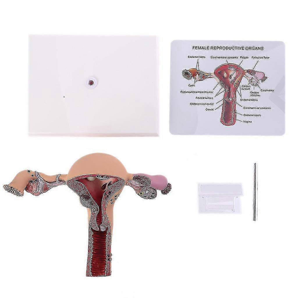 Human Female Uterus Ovary Disease Dissection Pathology Model Biology ...