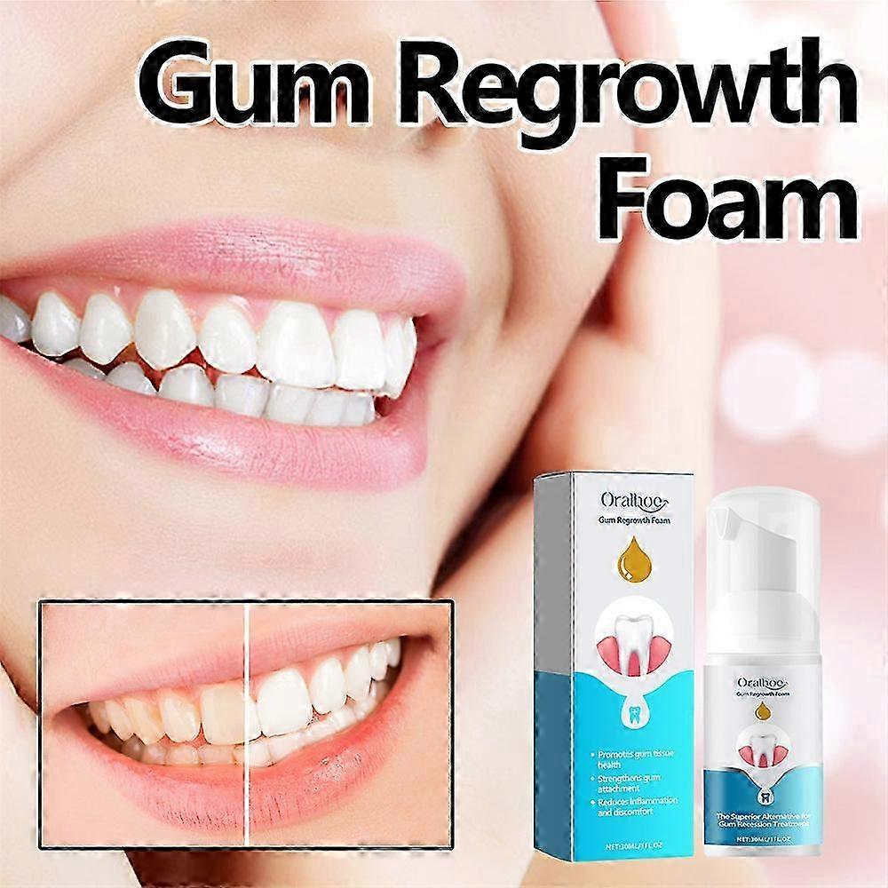 New Gum Regrowth Foam, Gum Treatment Foam, Anti Inflammatory, Gum ...