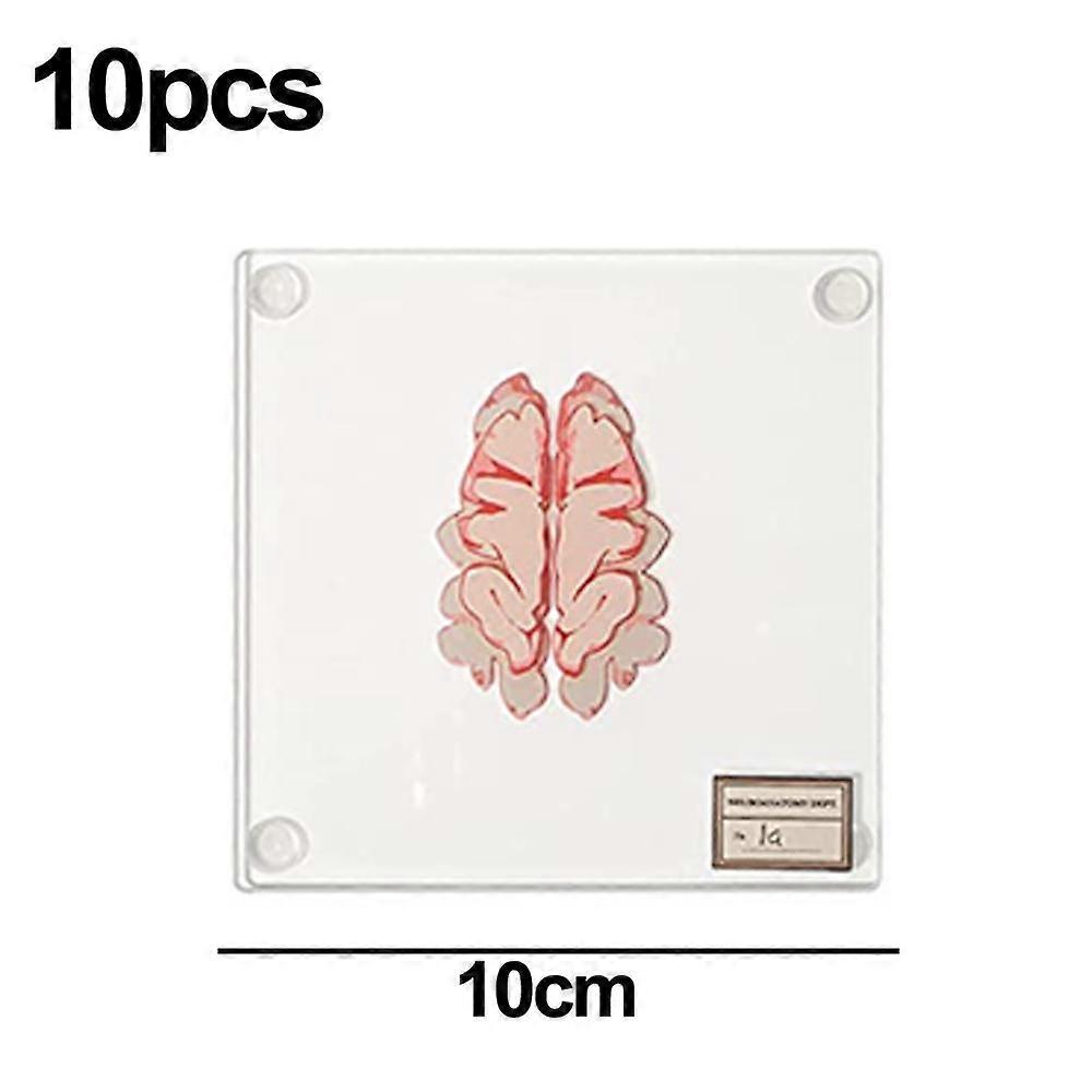 Anatomic Brain Specimen Coasters - Unique Medical Student Gifts - Human ...
