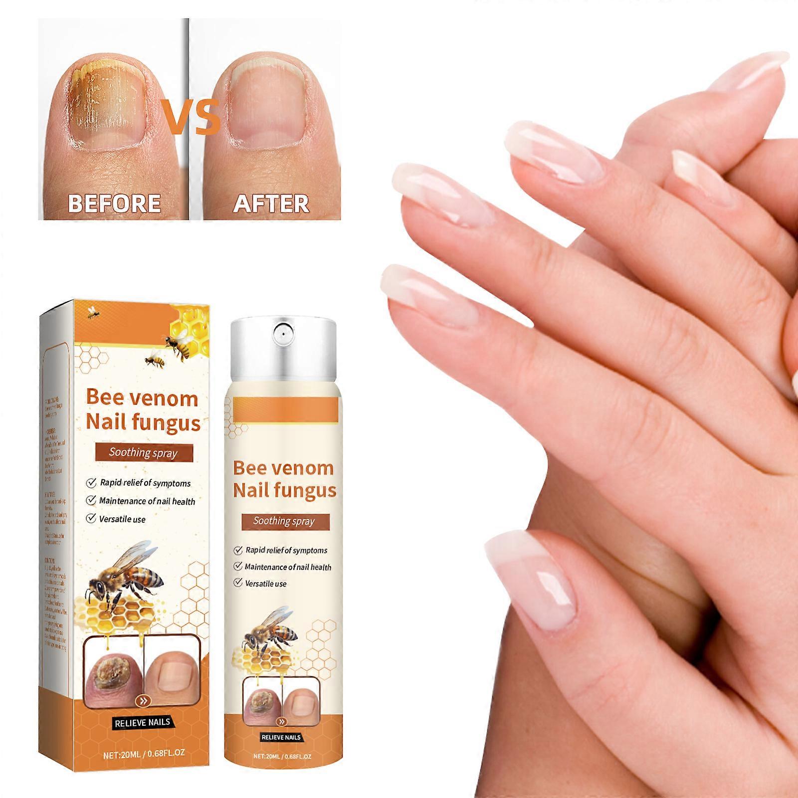 Bee Venom Nail Repair Serum, Nail Care Solution, Natural Bee Venom Nail ...