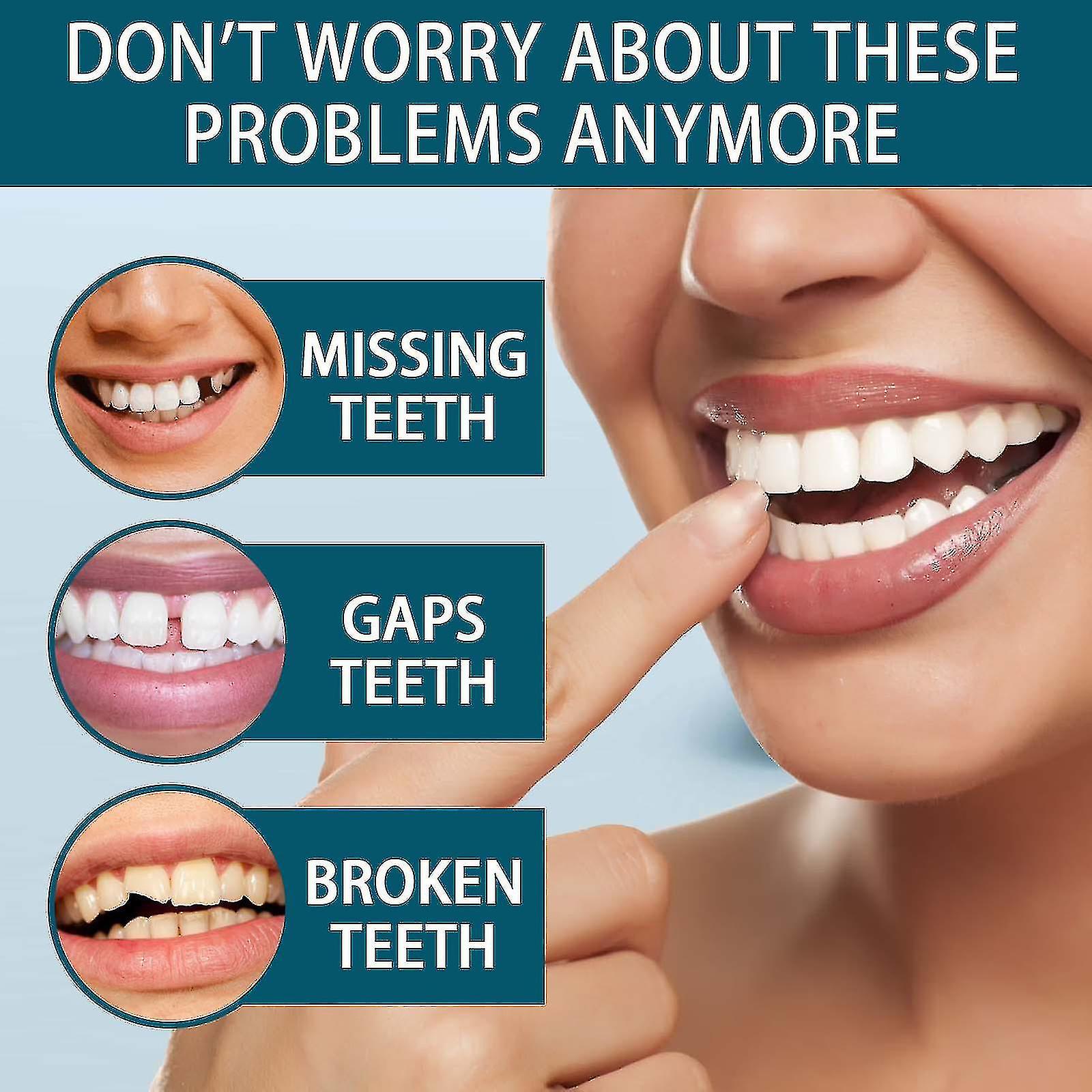 1-4 Pairs Denture Teeth Temporary Fake Teeth For Snap On Instant ...