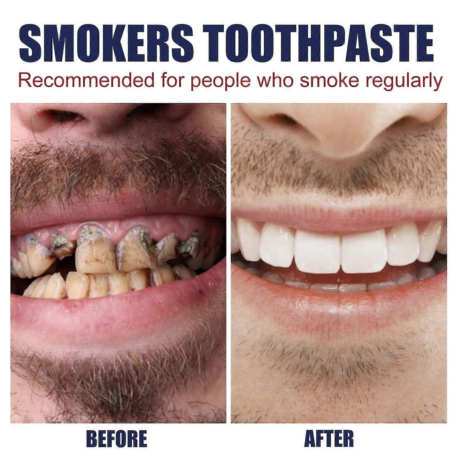 Remove Smoke Stains Toothpaste Smoke Stains Remove Teeth Stains Remove ...