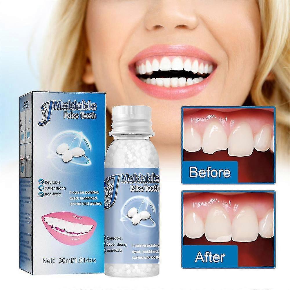 Temporary Dental Repair Kit Tooth Filling Lost Fillings Repair Caps ...