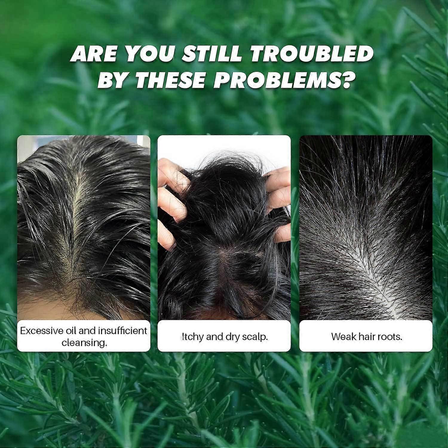 Peppermint Scalp Scrub, Rosemary Scrub with Massage Comb, Nourishing ...