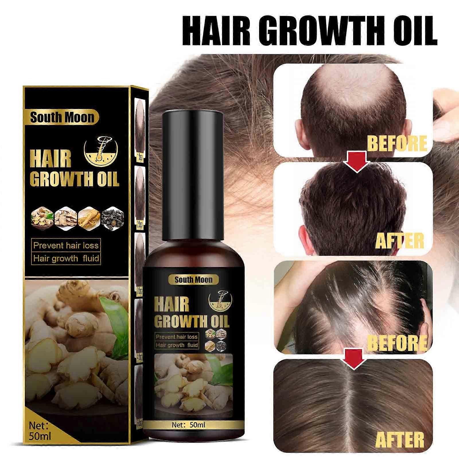 Ginger And Polygonum Multiflorum Growth Spray Sprayed Hair Spray To ...