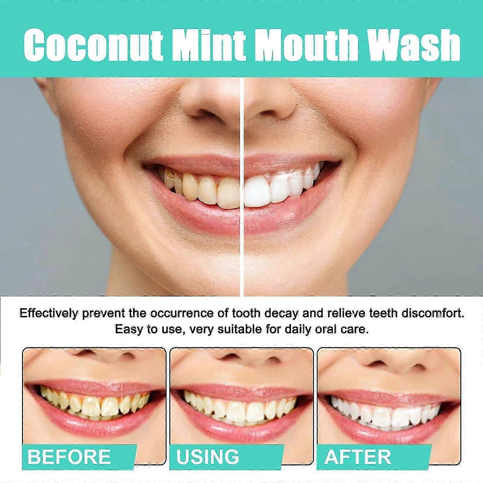 Coconut Mint Mouth Wash, Whitening Teeth Yellow Teeth Stains Tongue ...