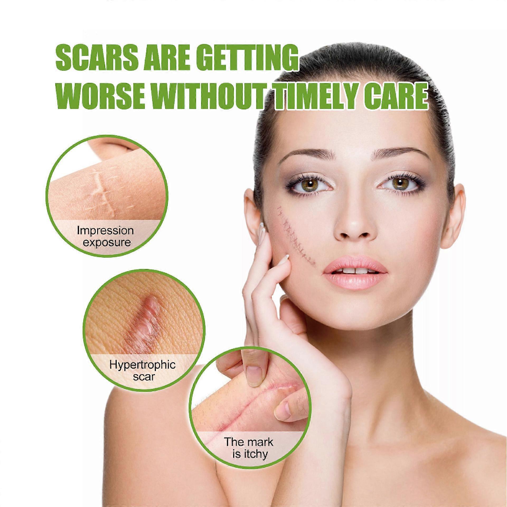Silicone Plasters For Scars, Silicone Scar Films For Surgeries, Caesarean Section, Keloids ...