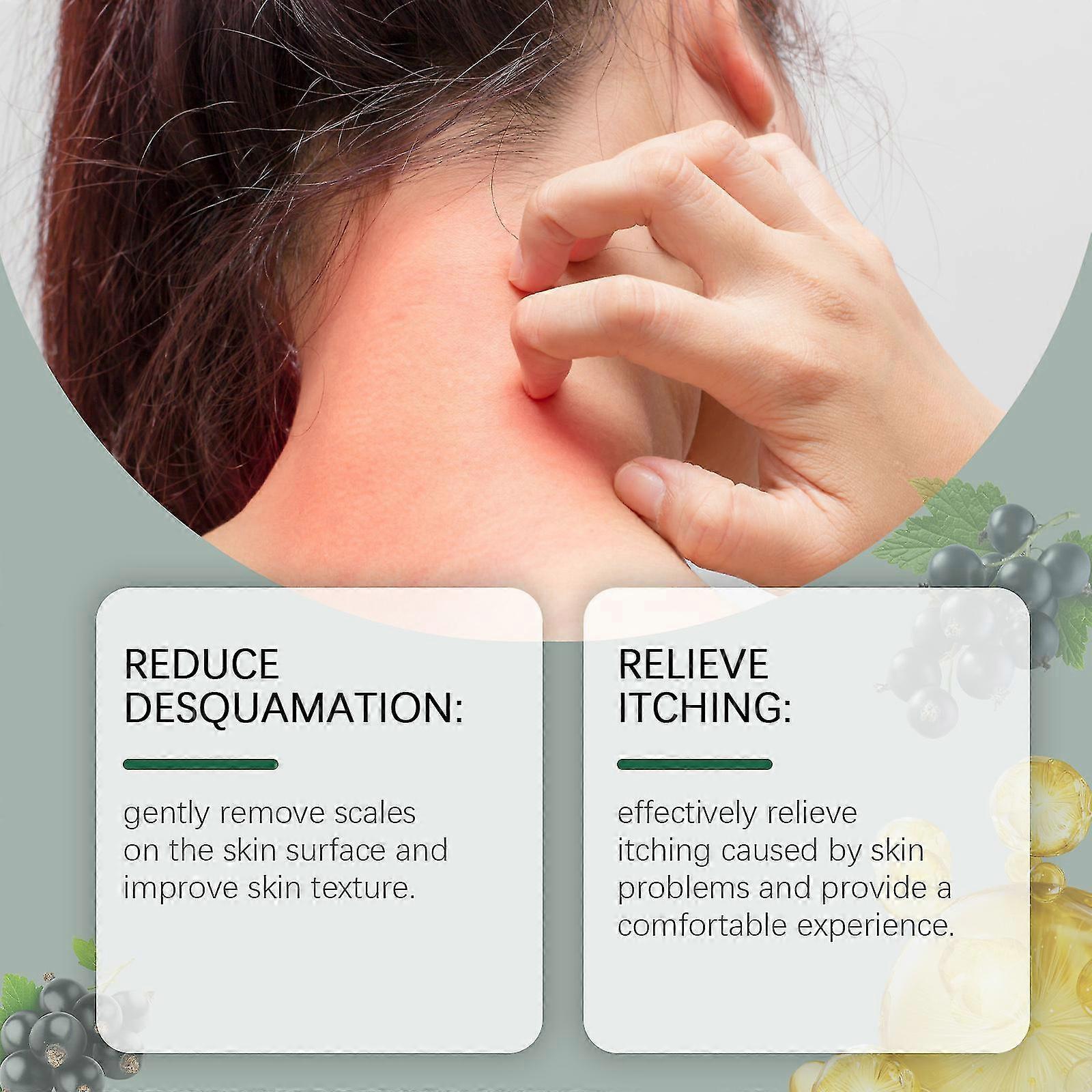 Psoriasis Soap, Psoriasis & Eczema Soap Bar for Face and Body, All ...