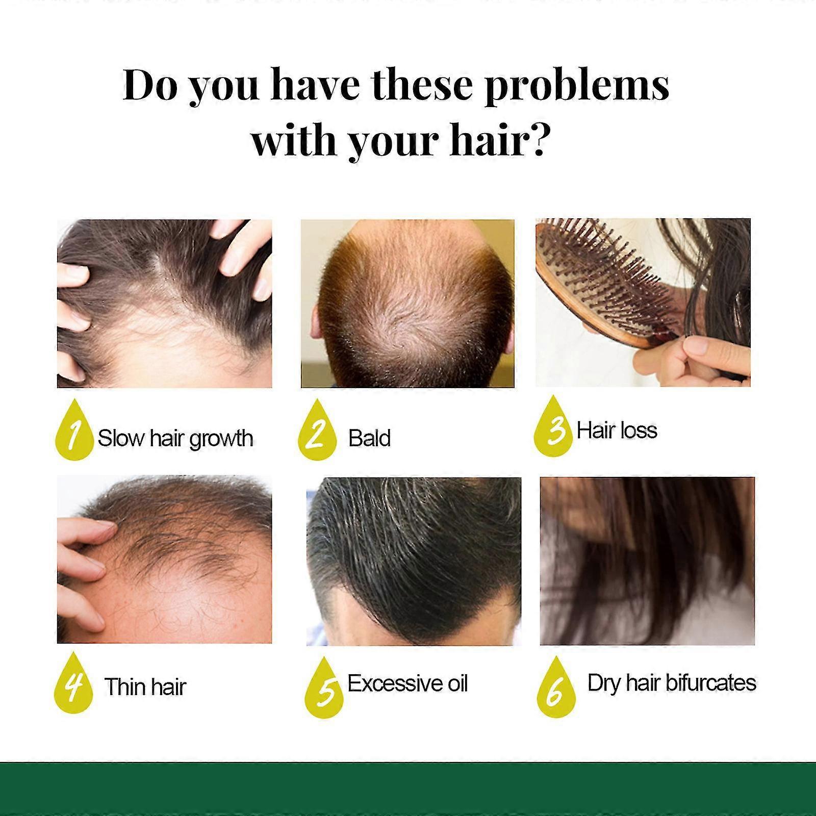 Eelhoe Ginger Hair Growth Spray 50ml | Fruugo UK