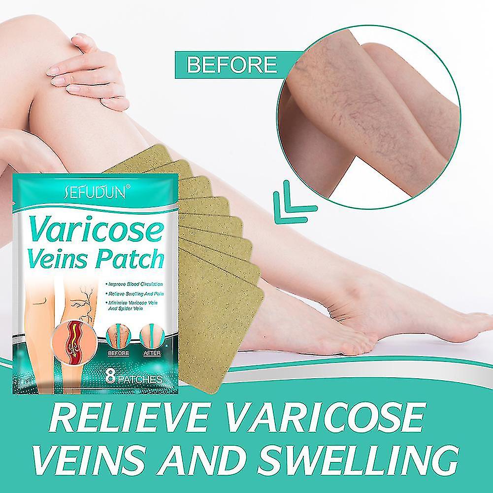 Leg Varicose Vein Repair Patch Professional Earthworm Leg Care Safety ...
