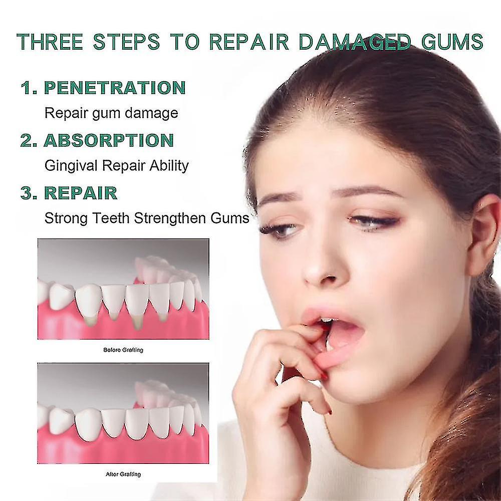 3pcs Quickly Repair Of Cavities Caries Mousse Teeth Clean Whiten Remove ...