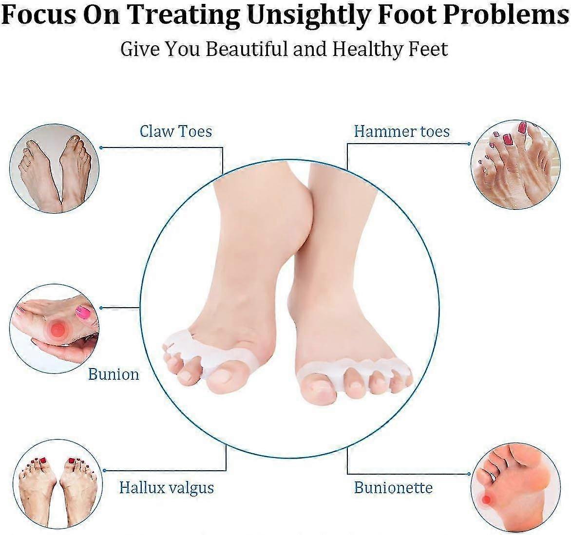 Toe Separator For Toe Correction Toe Yoga 10-piece Silicone Hammer Toe ...