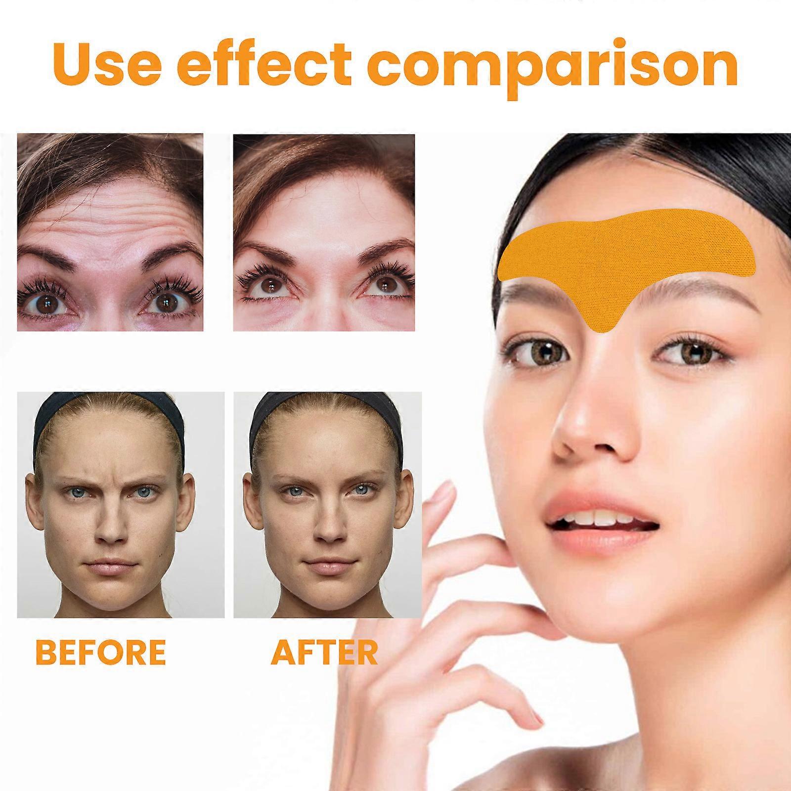 Forehead Wrinkle Patches 10 Pcs,Forehead Patches for Wrinkles,Wrinkle ...