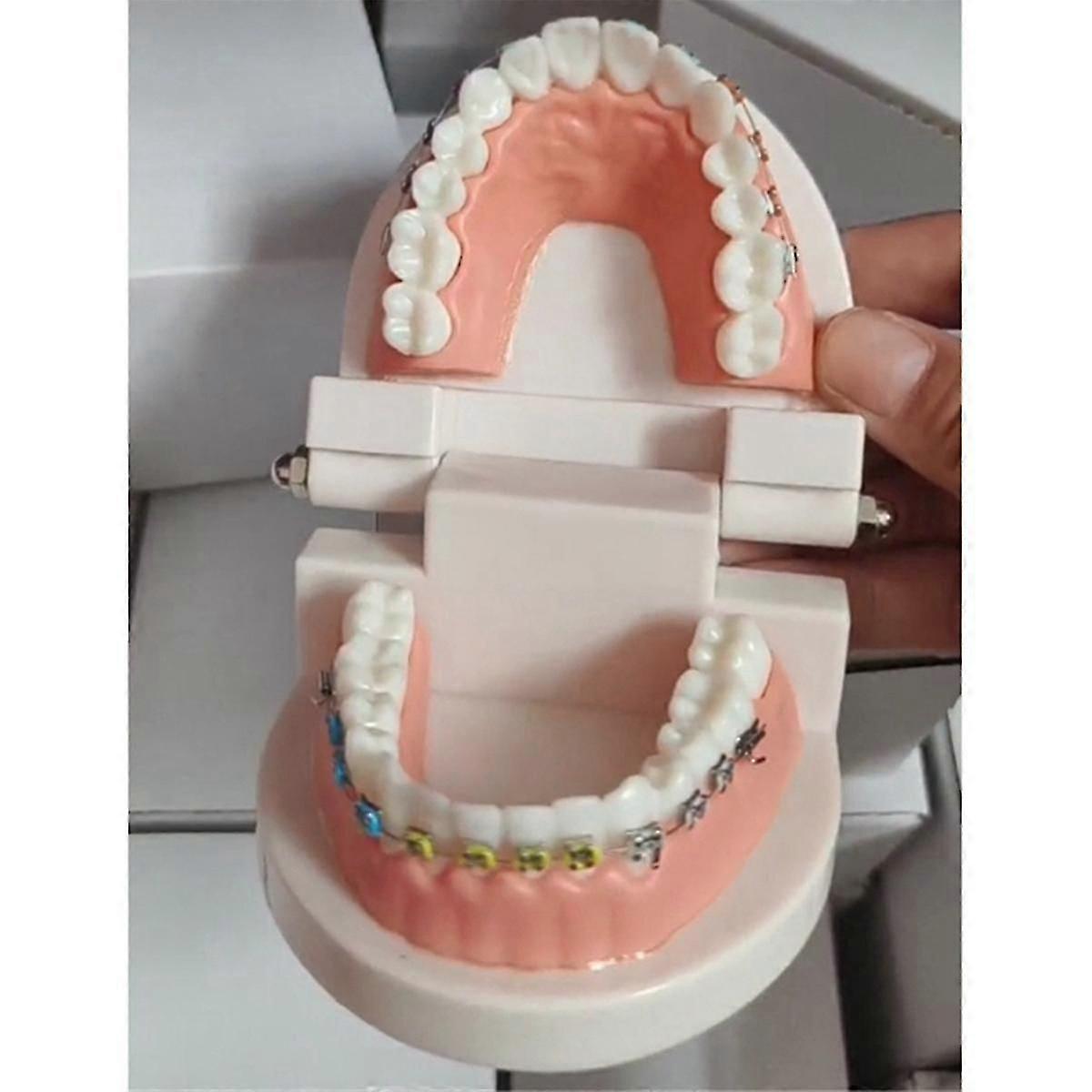 Dental Orthodontic Treatment Teeth Model with Bracket Arch Wire Buccal ...
