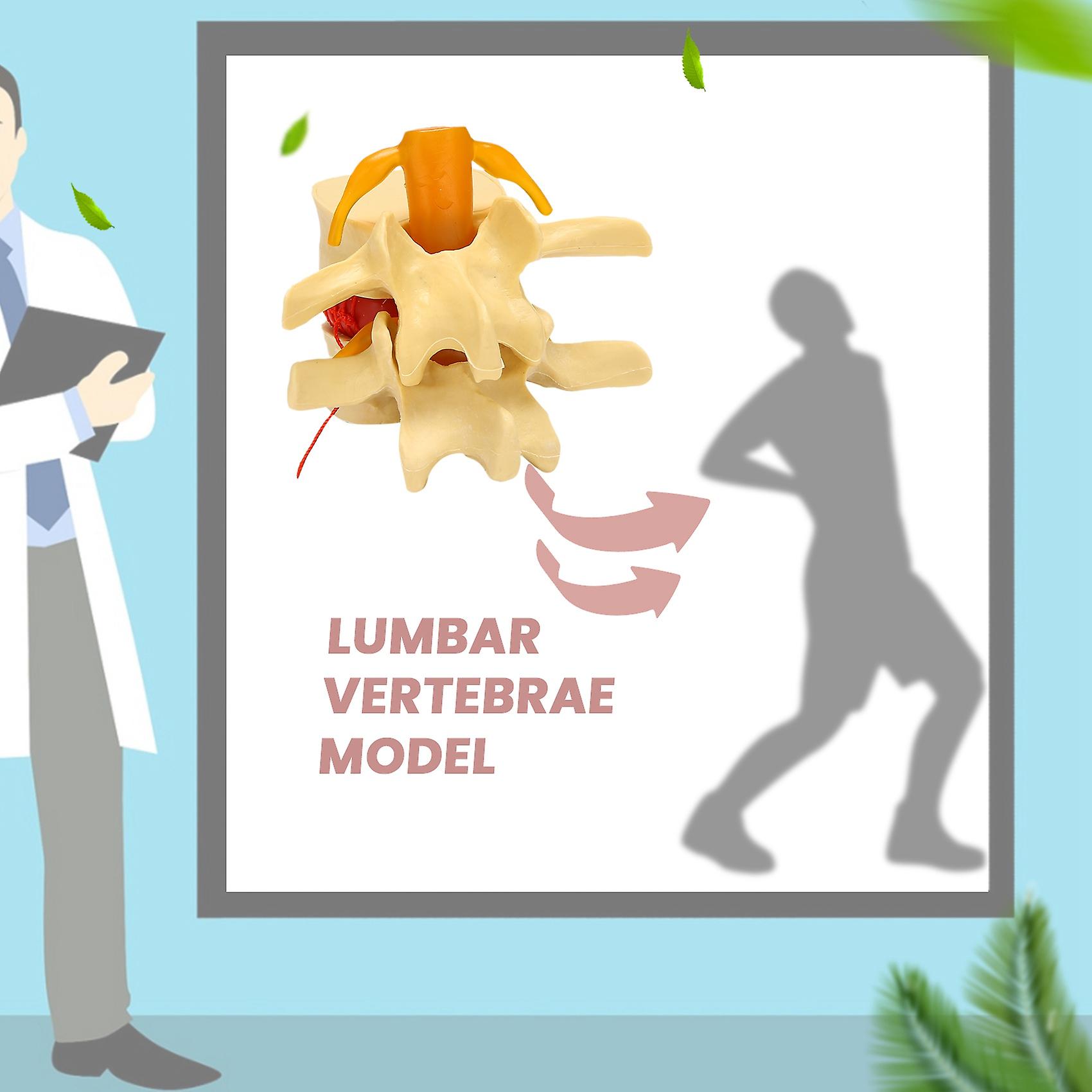 Modello di vertebre lombari Colonna vertebrale anatomica Ernia del ...