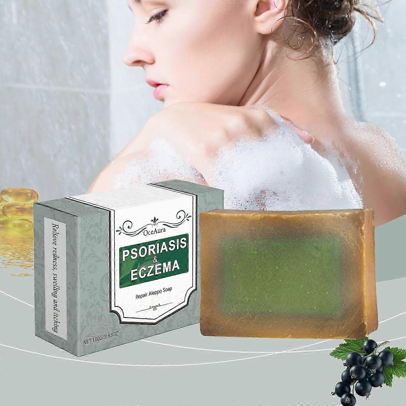 Psoriasis Soap, Psoriasis & Eczema Soap Bar for Face and Body, All ...