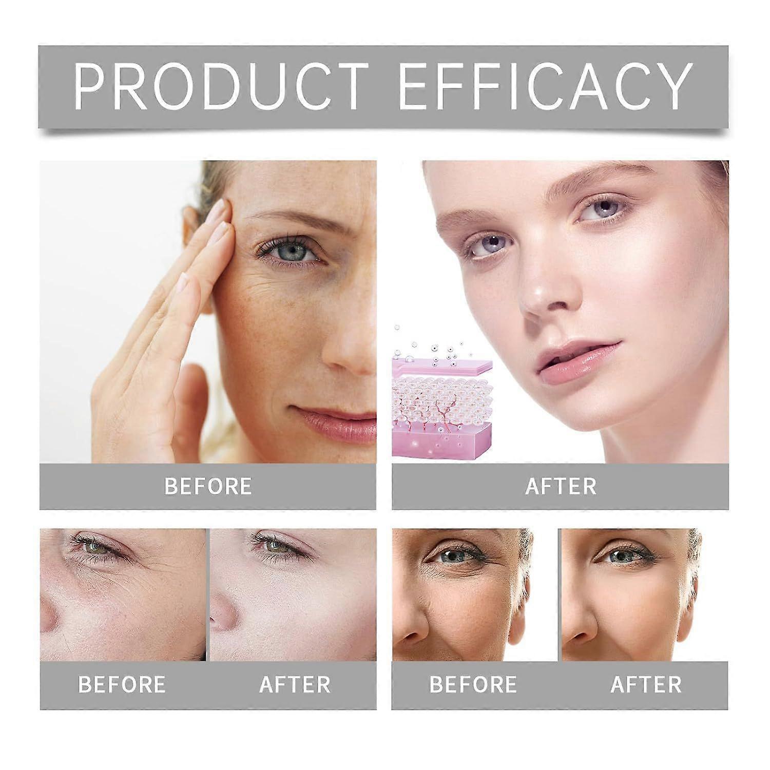 Sistema de Micro Infusión para la Cara, Kit de Infusión Micro Needling ...