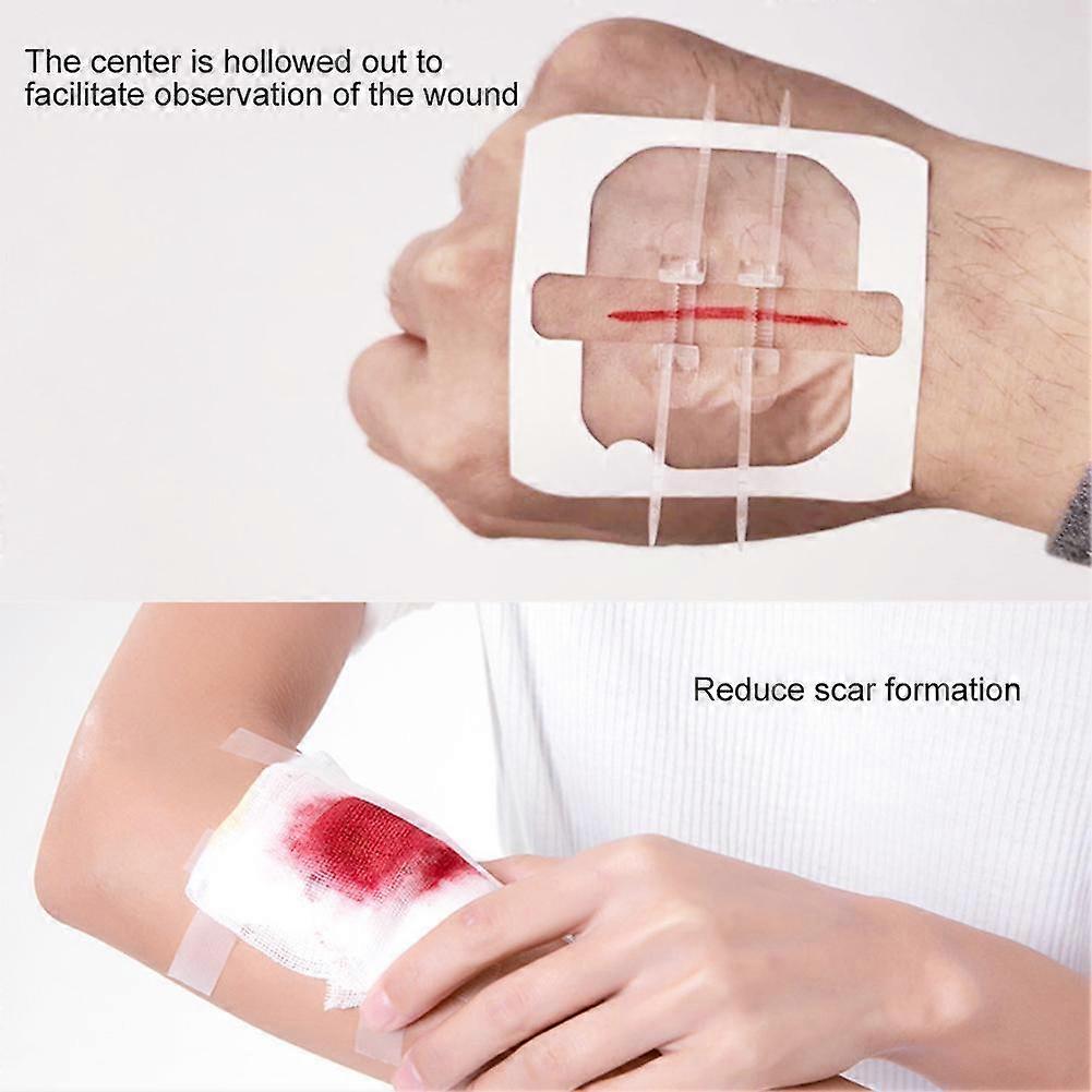 Zipper Band-Aid for Painless Wound Closure - Suture-Free Dressing ...
