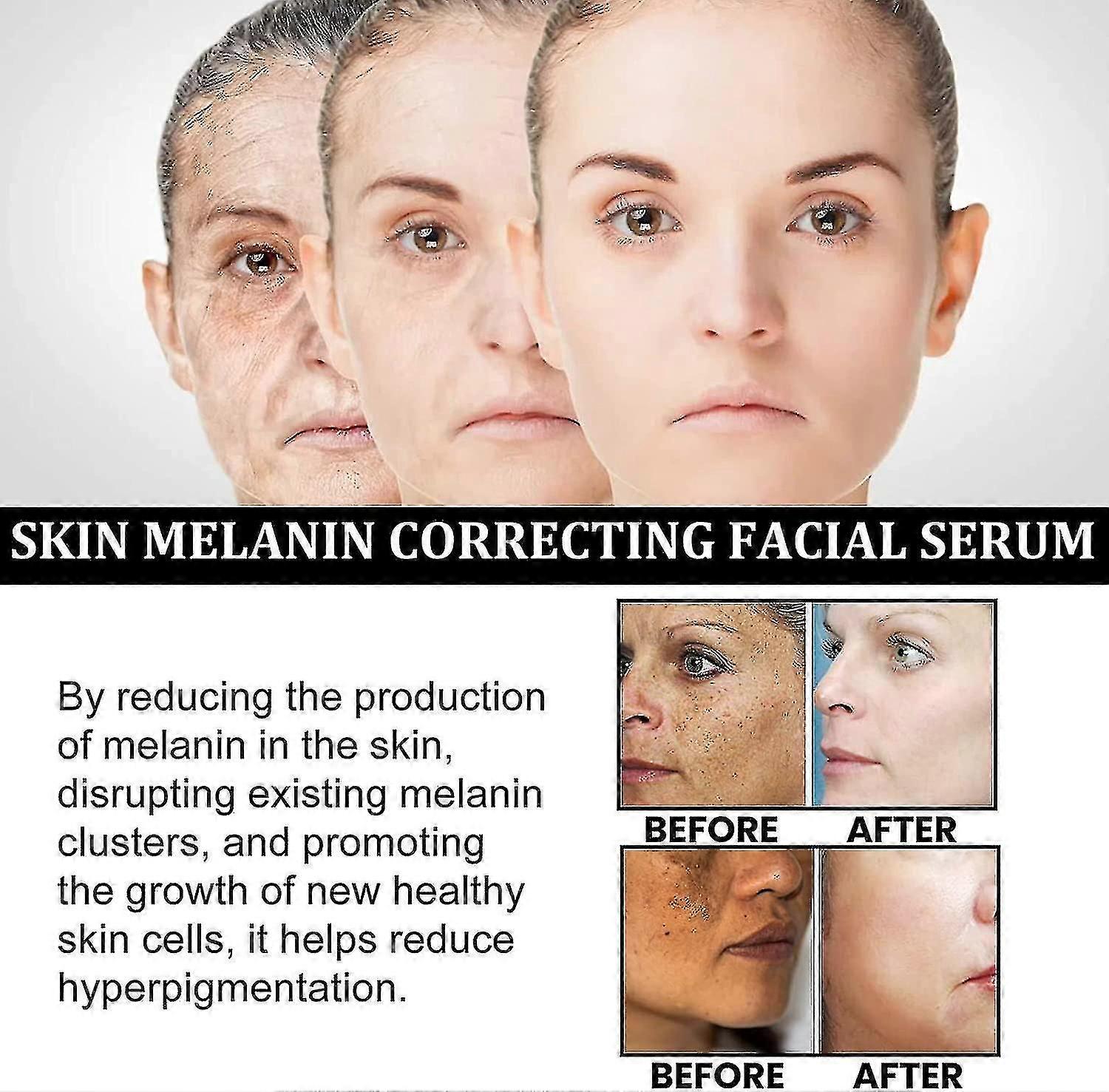 Melanin Correcting Facial Serum,hyaluronic Acid Vitamin C Serum For Face,anti-aging Brightening ...