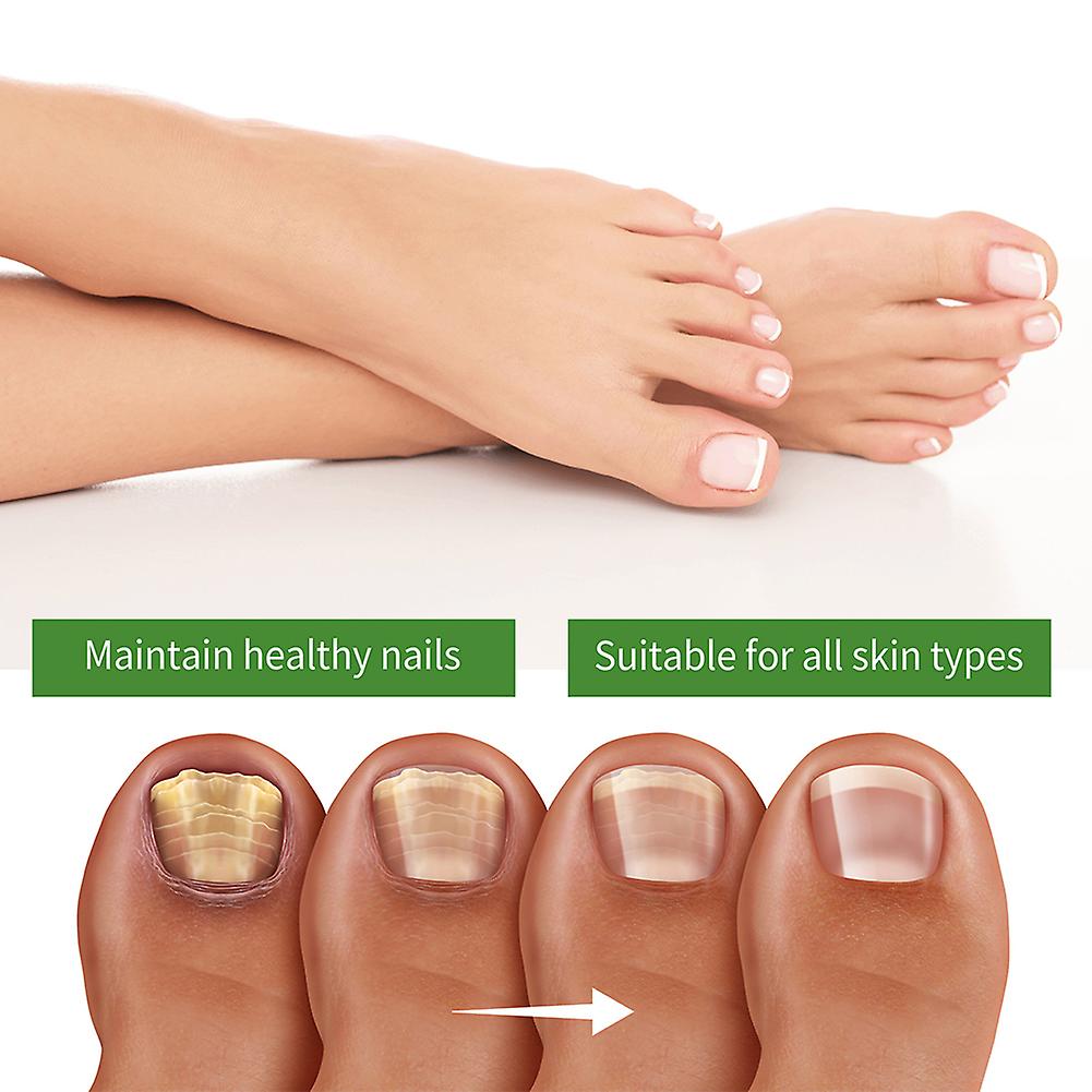 10ML Health Toenail Stick Roller Bead Onychomycosis Care Solution for ...