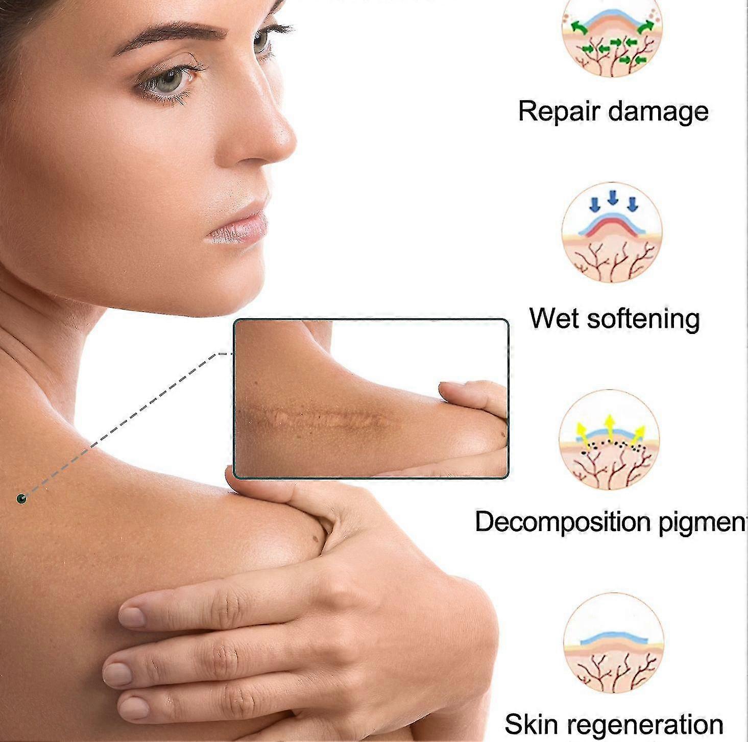 Scar Stickers Self-adhesive Scar Stickers Wound Stickers Cesarean ...