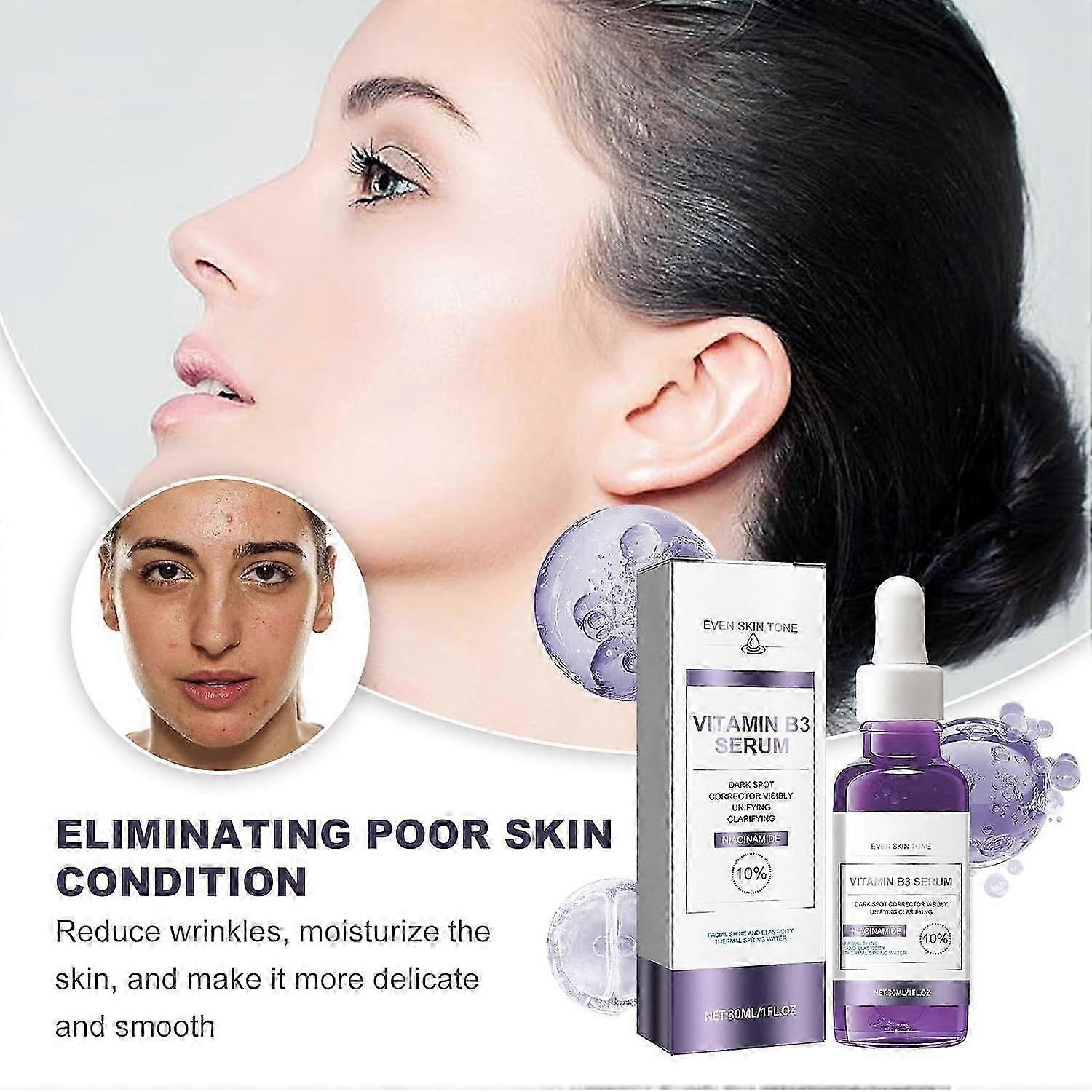 Vitamin B3 Serum,Dark Spot Corrector With Anti-Aging Face Serum+10% ...