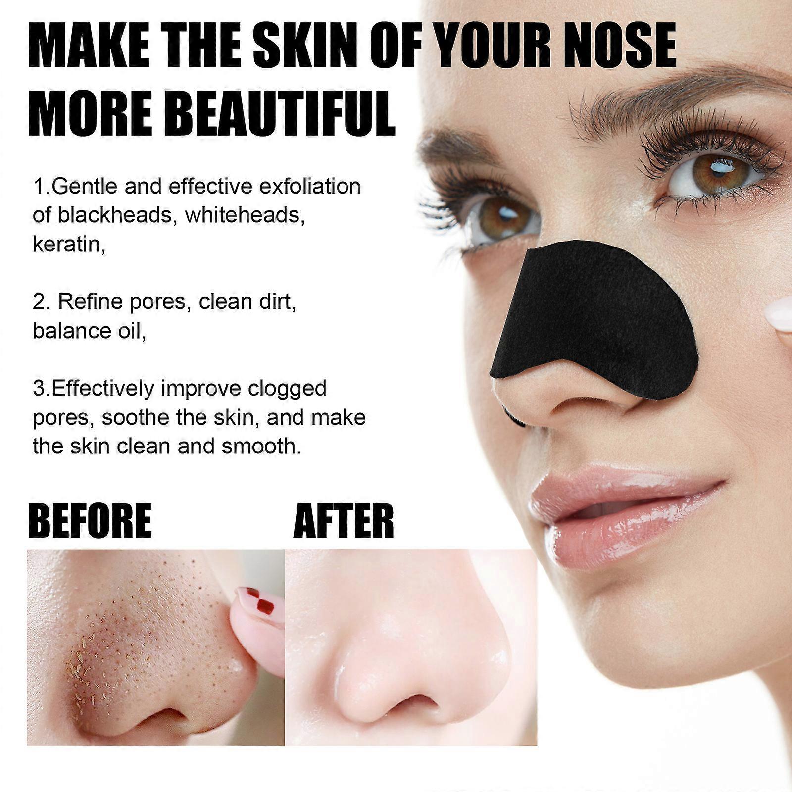Nose Strips, 10 Pcs Pore Strips, Charcoal Blackhead Remover Strips,Deep ...