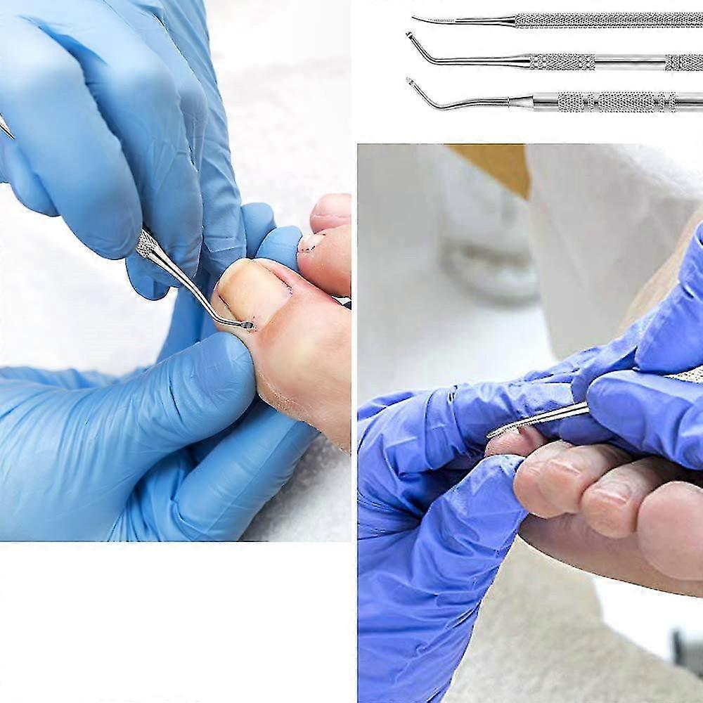 Ingrown Toenail File Lifter Set Ingrown Nail Feet Care Pedicure Tools ...