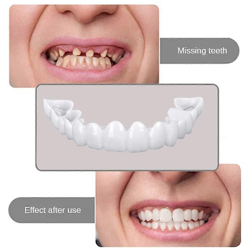 Patches Moldable Tooth Model Mouthguard Whitening Tool Braces ...