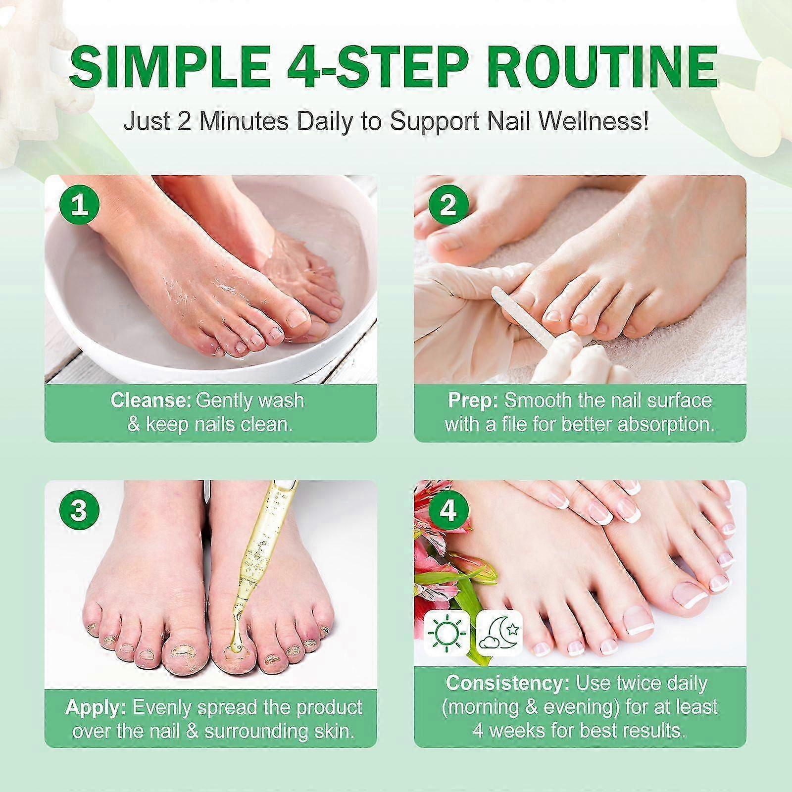 Nail Fungus Treatment, Ginger Nail Fungus Treatment, Toenail Cuticle ...