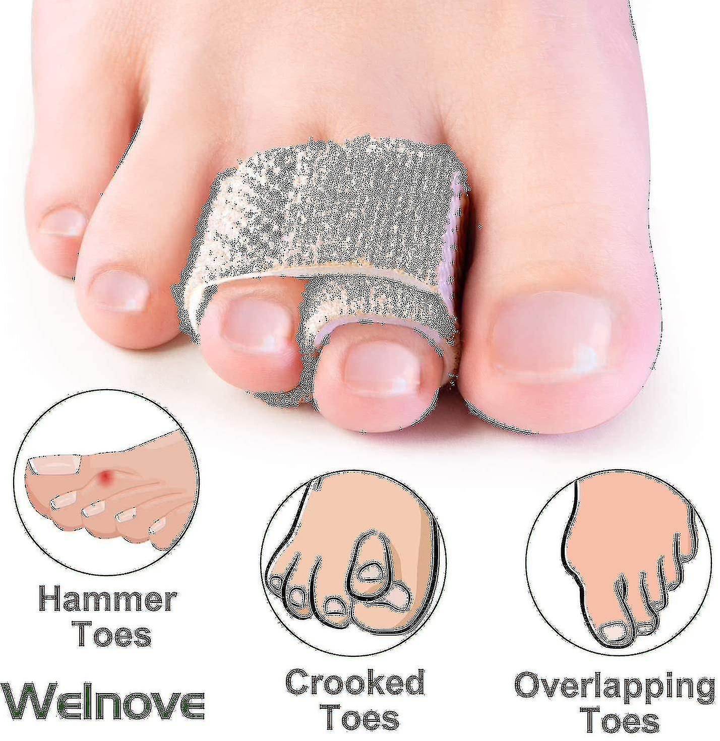 6-pack Of Hammer Toe Straighteners For Straightening Hammer Toes ...