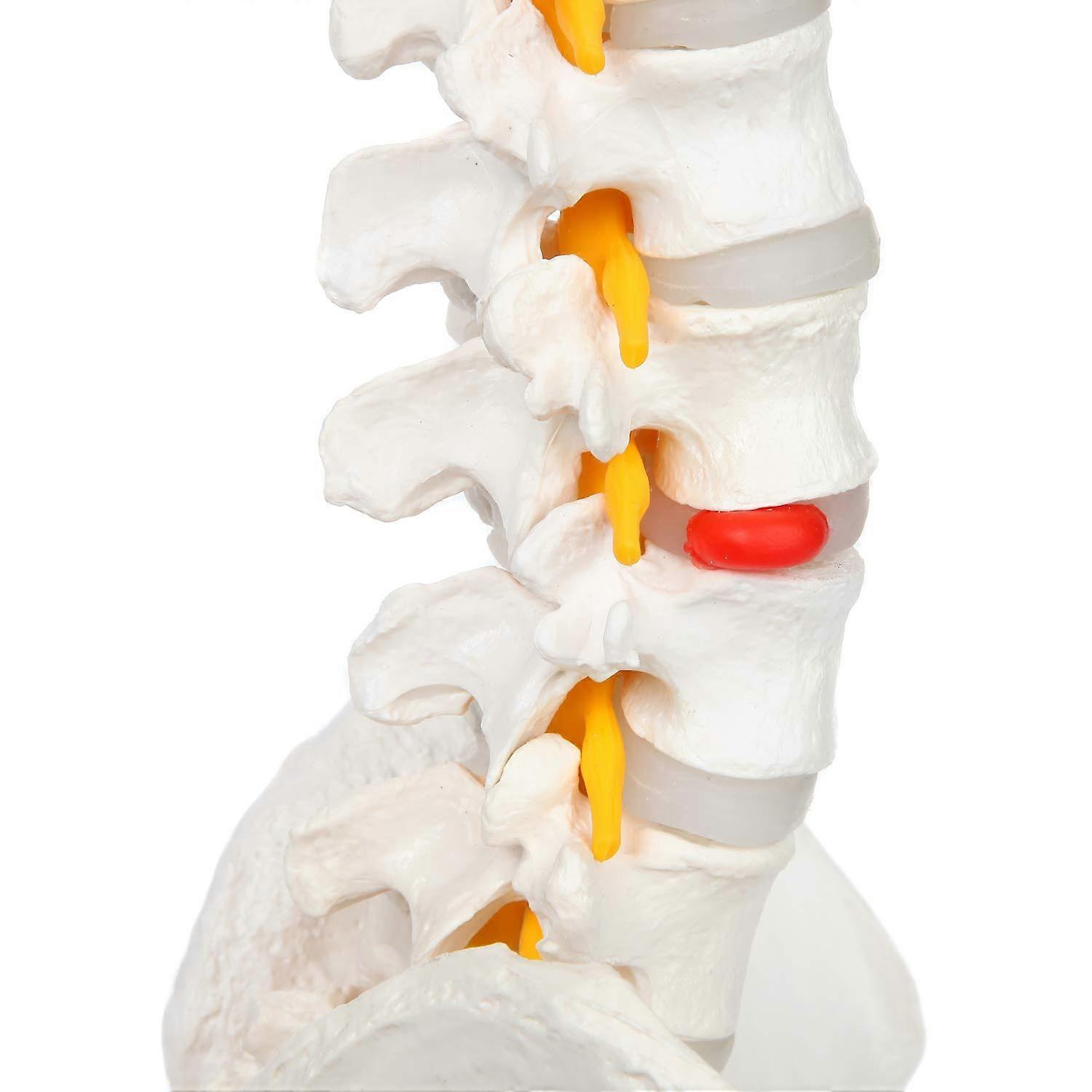Full Size Ultra Flexible Spine Model with Removable Femur Heads ...