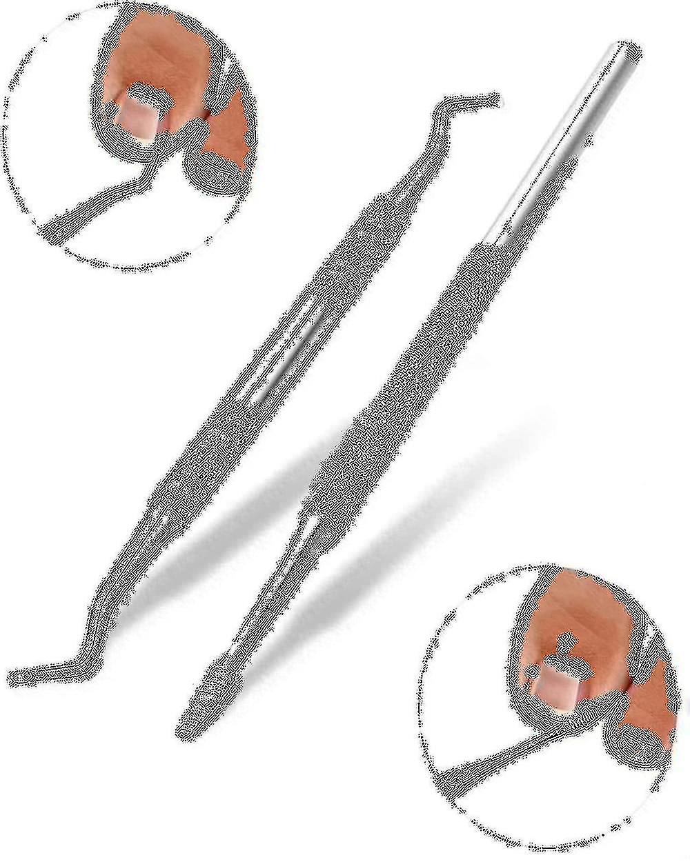 (50+2) Pack Professional Ingrown Toenail Correction Treatment Kit, 50 ...