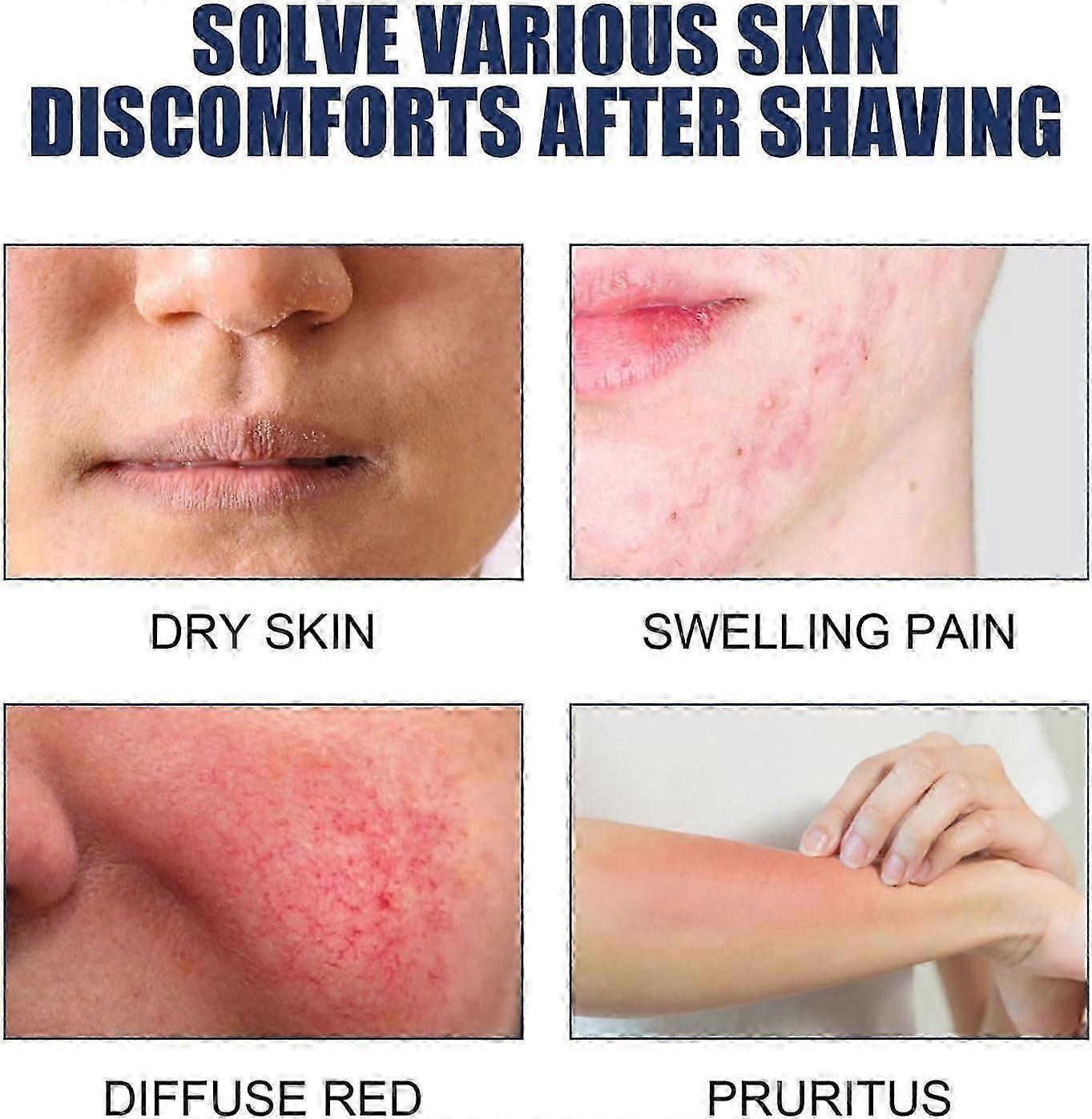 Razor Bumps Treatment for Women and Men, After Shave Solution Roll-On ...