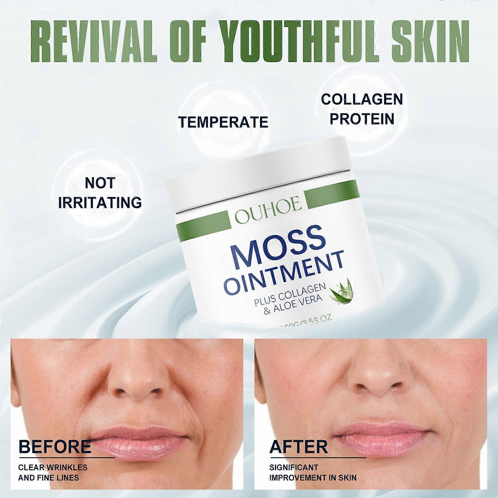 Moss Ointment Plus, Moss Anti-Wrinkle Cream, Fast Acting Facial Anti ...