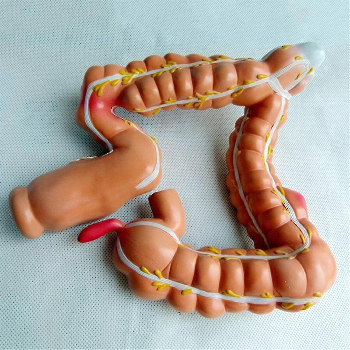 Teaching Model,human Large Intestine Anatomy Model Visceral Lesion ...