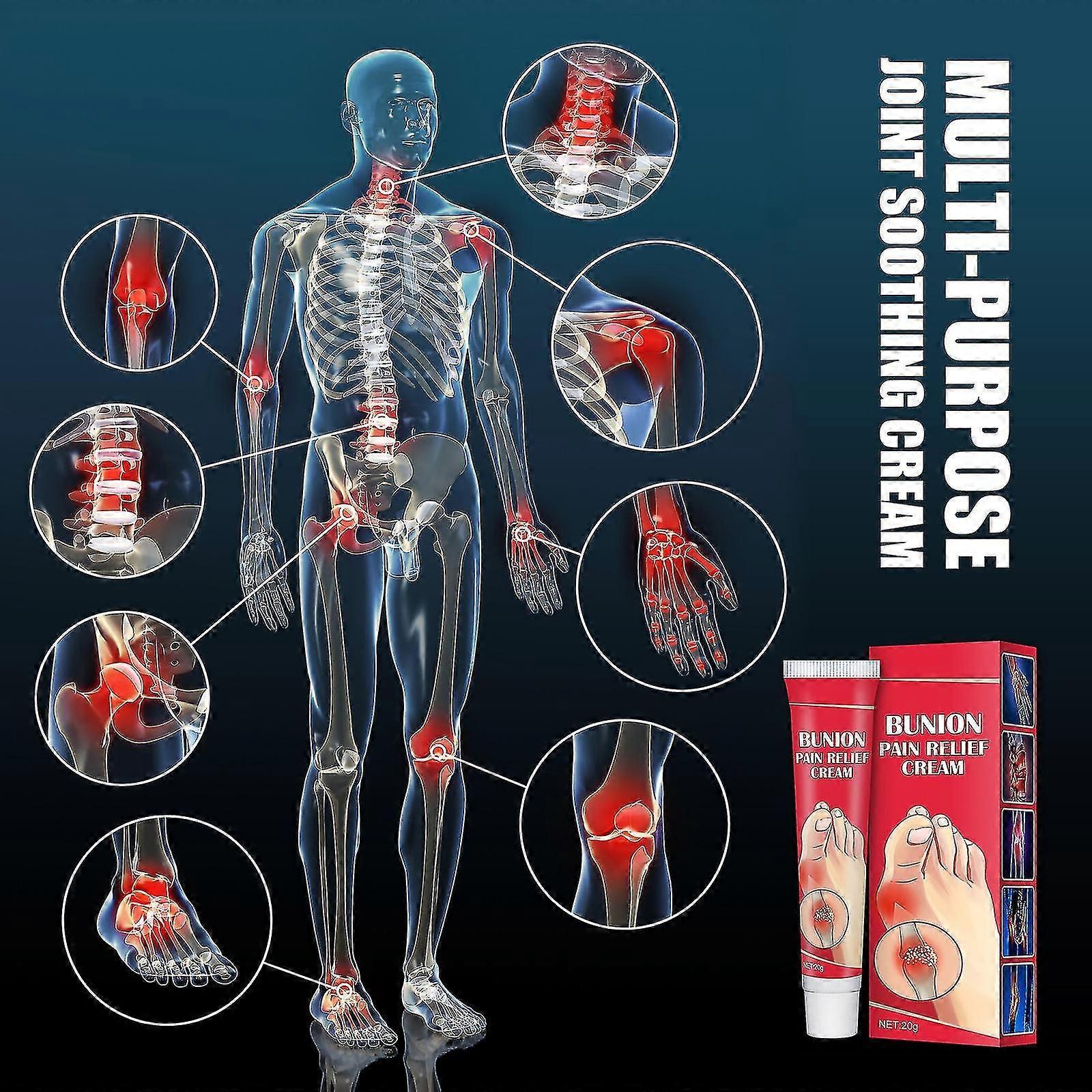 Bunion Pain Relief Cream, 20g Bunion Pain Cream For Bunion Relief & Toe ...