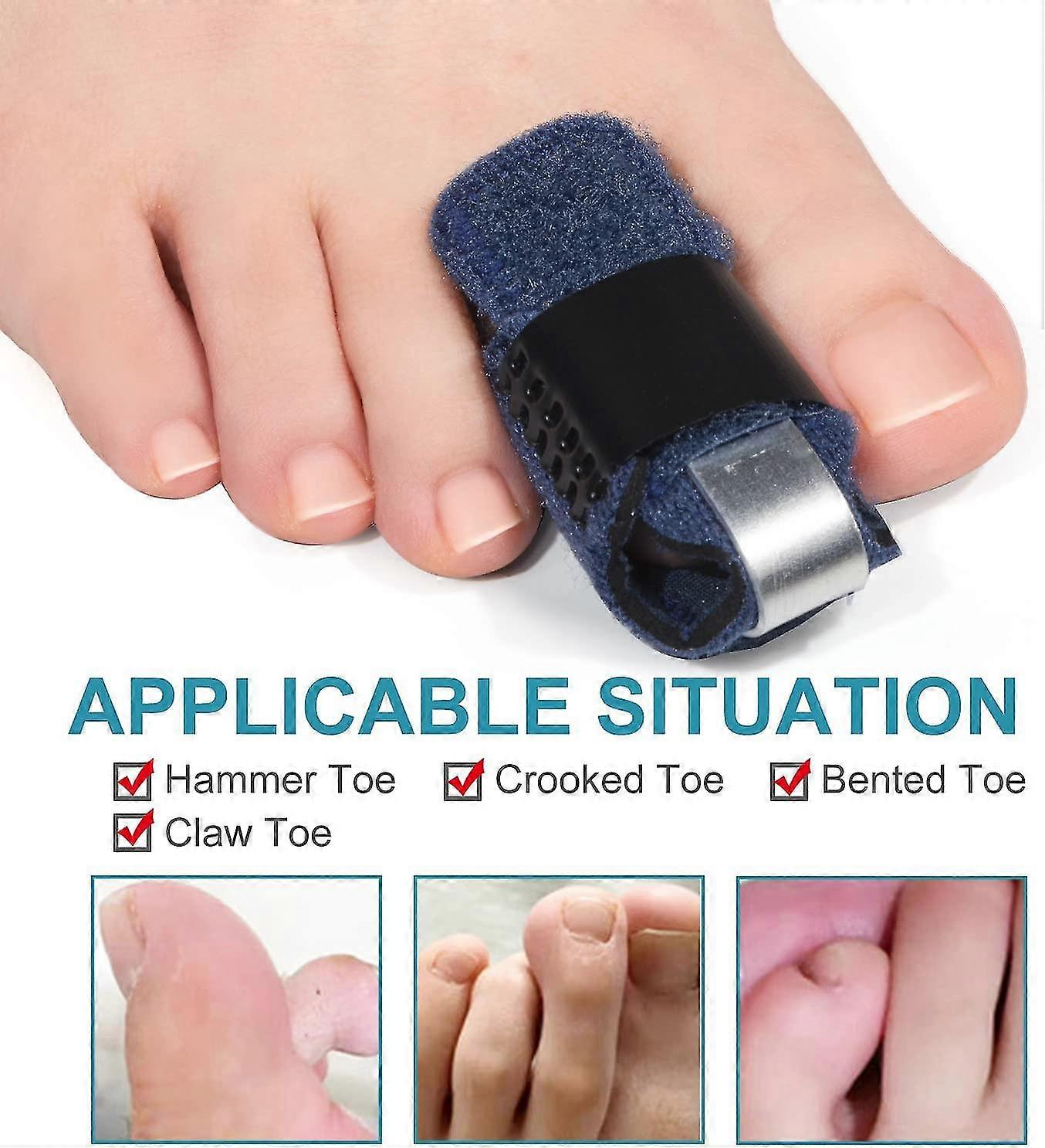 1 Pair Toe Splint,toe Straightener For Hammer Toe,bent Toe,claw Toe ...
