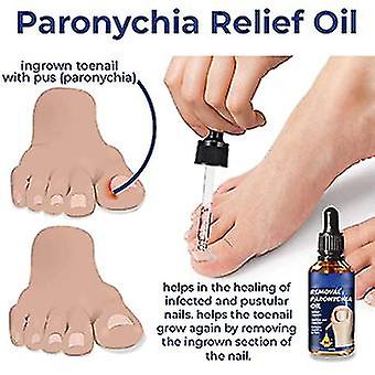 3pcs German Toenailcare Oil For Removing Paronychia, Nail Care And ...