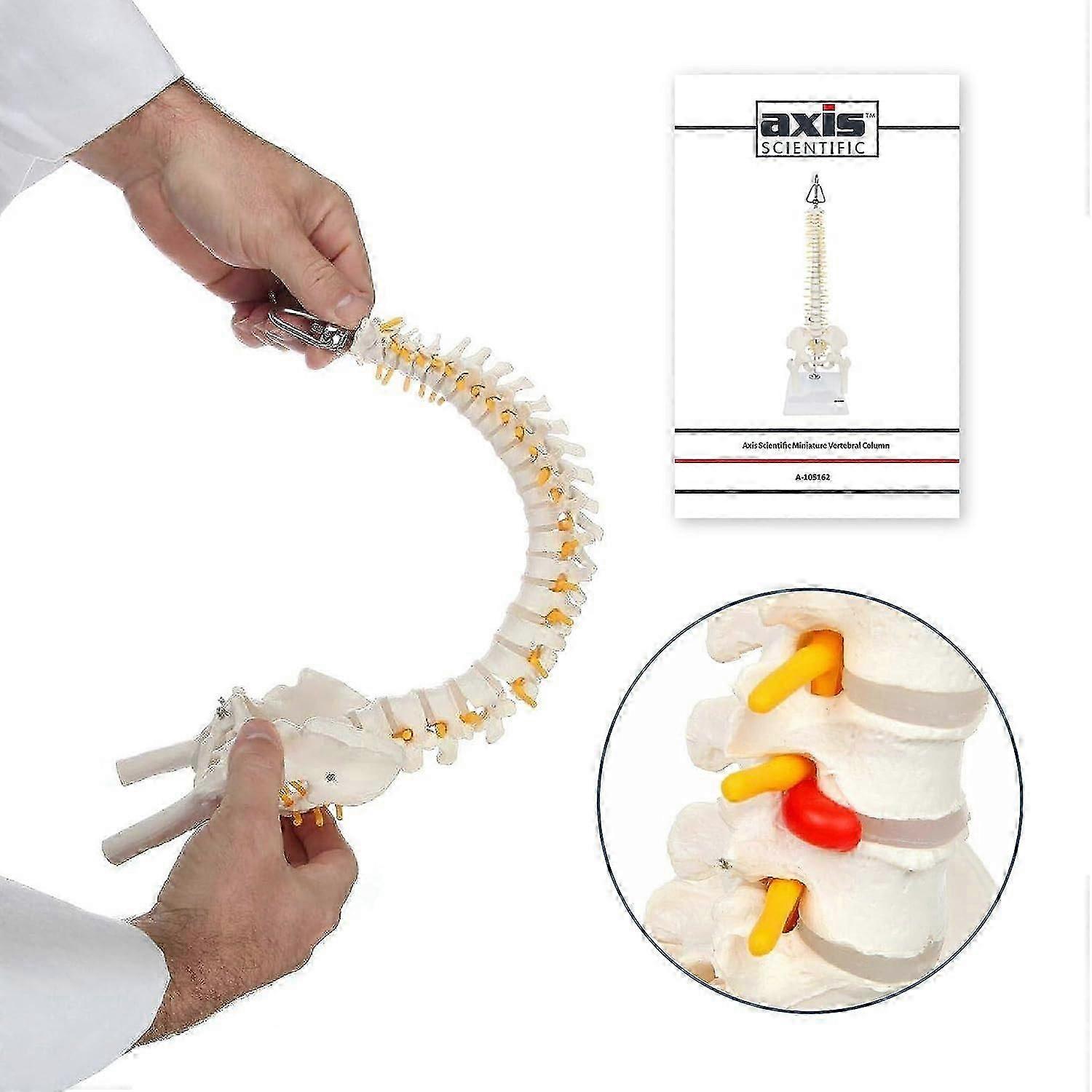 15.5" Mini Spine Model with Vertebrae,Nerves,Arteries, Lumbar Column ...
