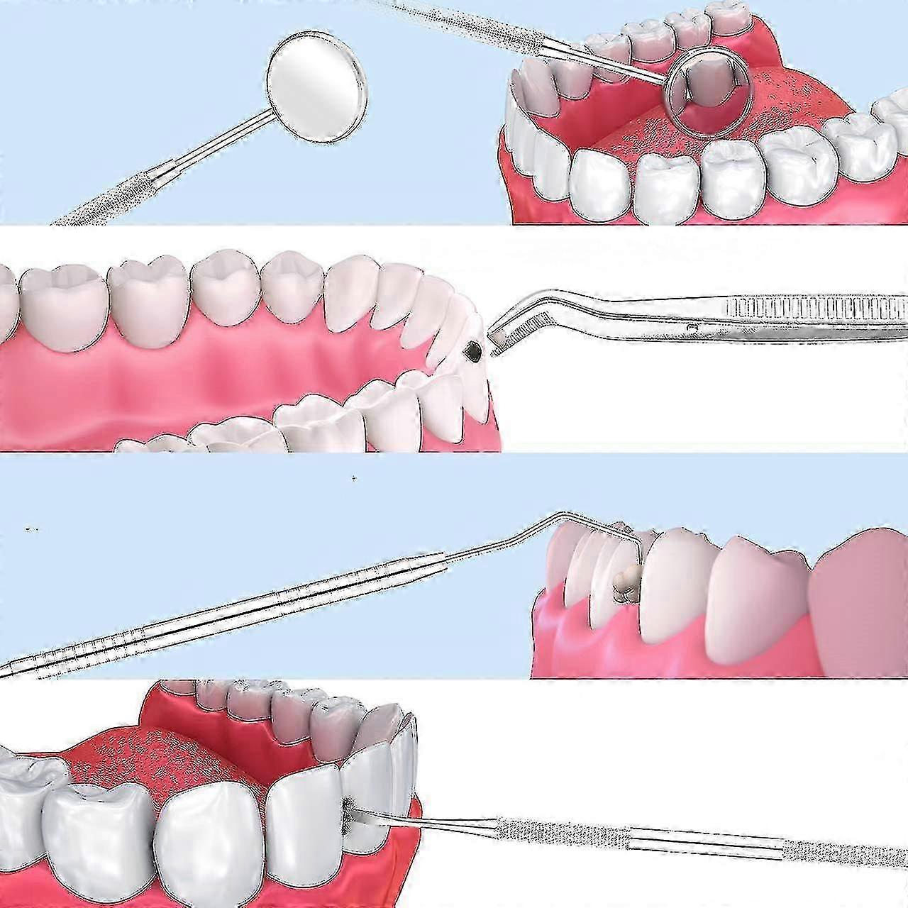 8-Piece Stainless Steel Dental Care Set for Professional Dentists ...