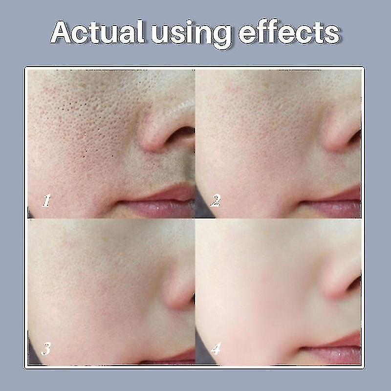 Pore Shrinking Serum Essence Pores Treatment Relieve Dryness Oil ...