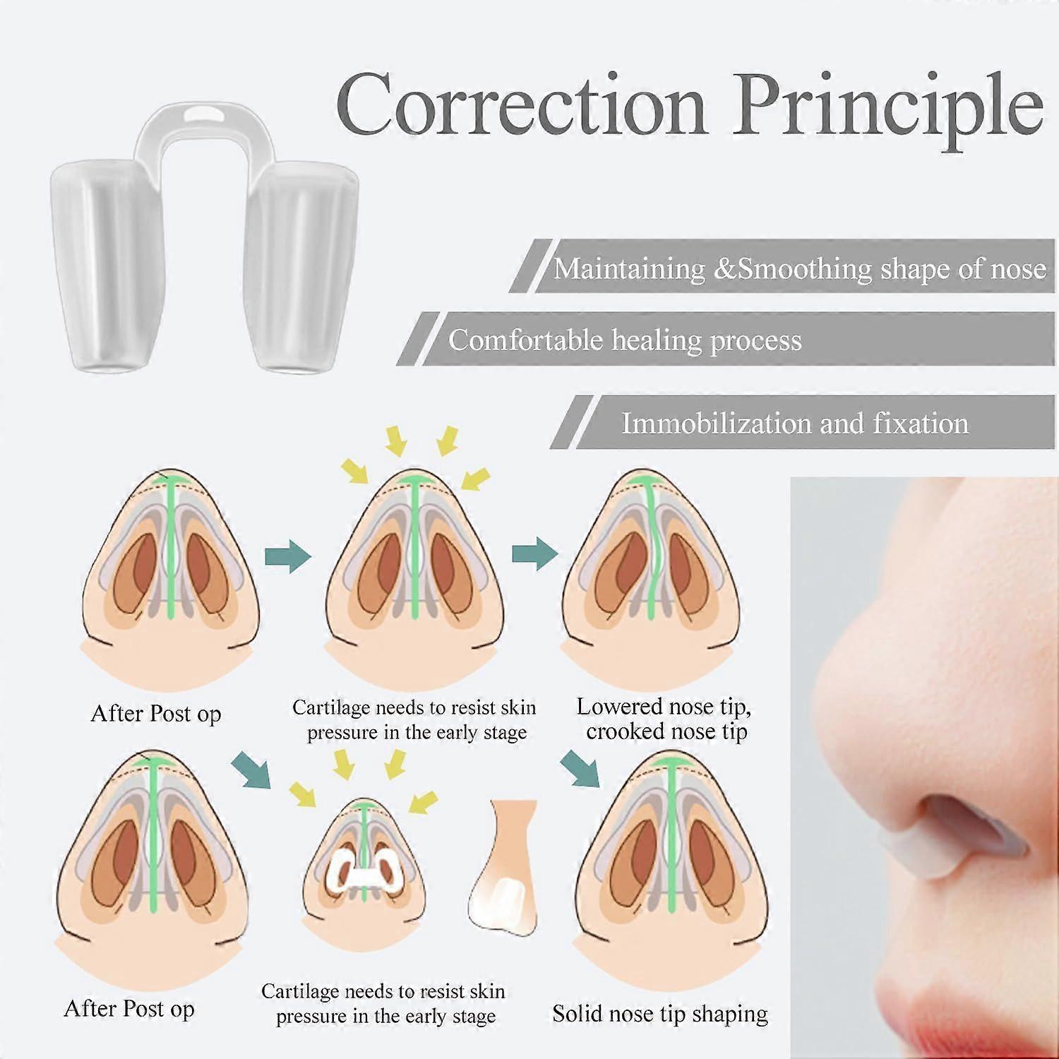Nostril Retainer - Nose Internal Support Protector for Brace Fracture ...