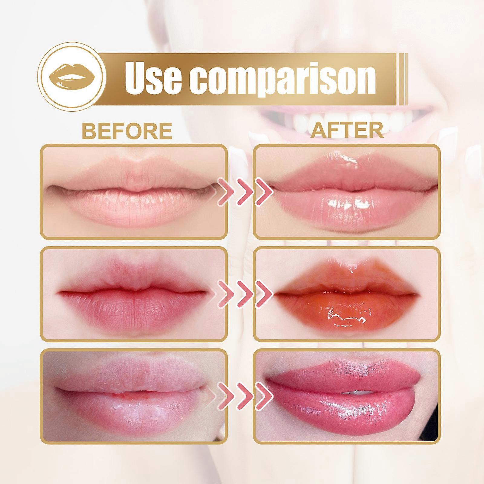 Lip Balm,Ultra Hydrating Lip Treatment Moisturizer and Volumizer ...