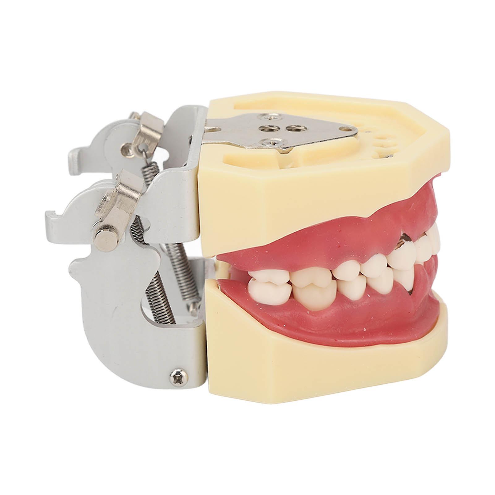 Periodontal Disease Teeth Resin Model Dental Demonstration Teeth Model ...