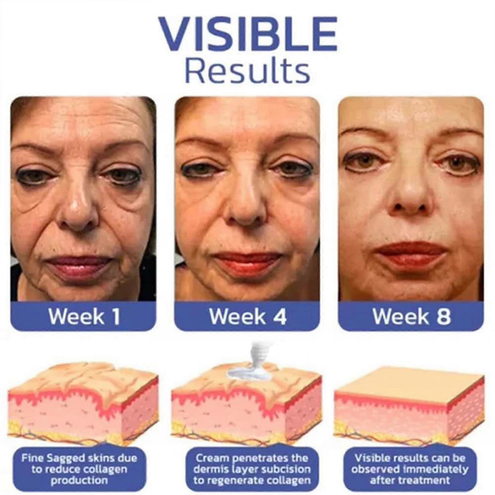 Lifting Eyelid Defining Cream, Double Eyelid Shaping Cream, Eyelid Lift ...